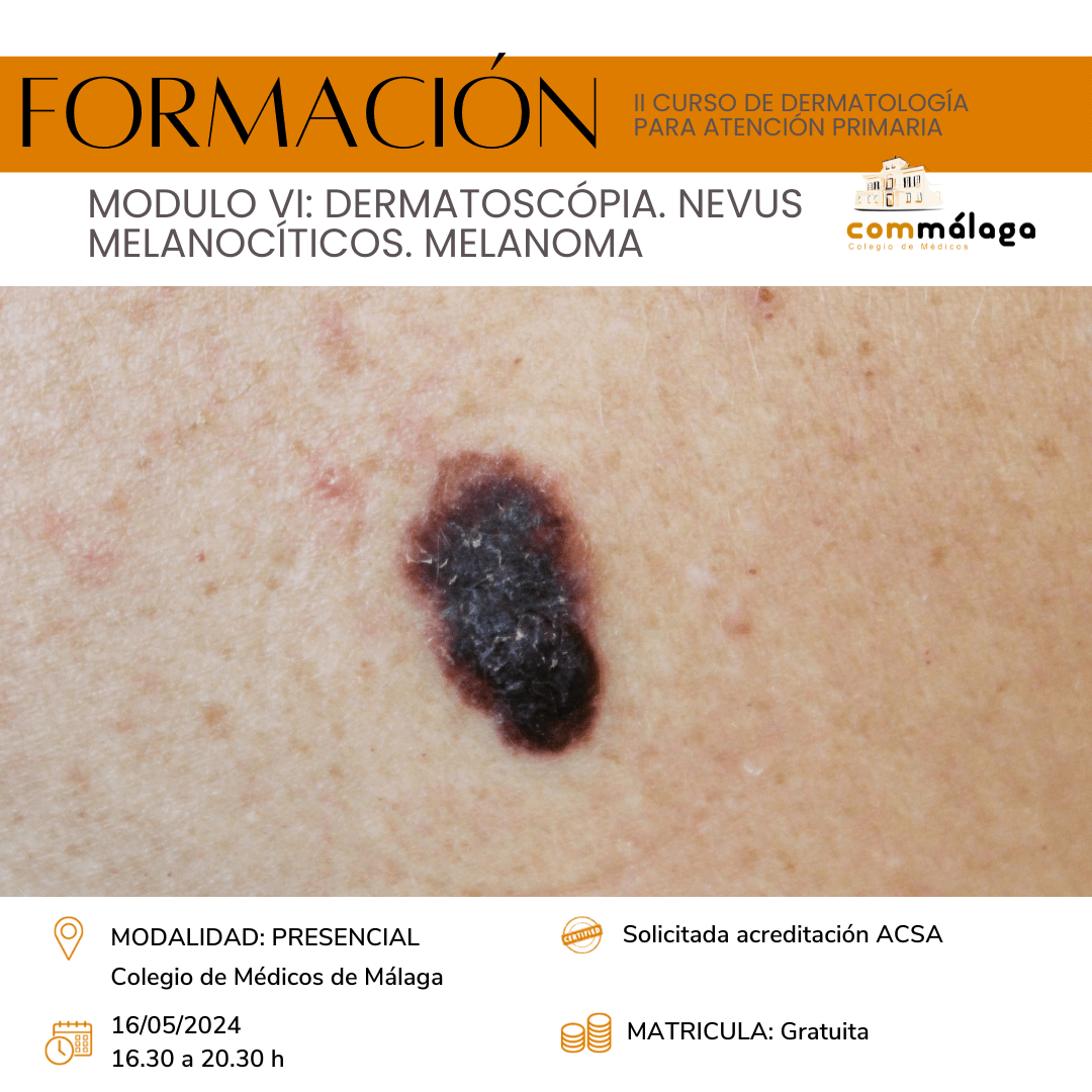 Módulo VI. Actualización en dermatoscopia, nevus melanocíticos y ...
